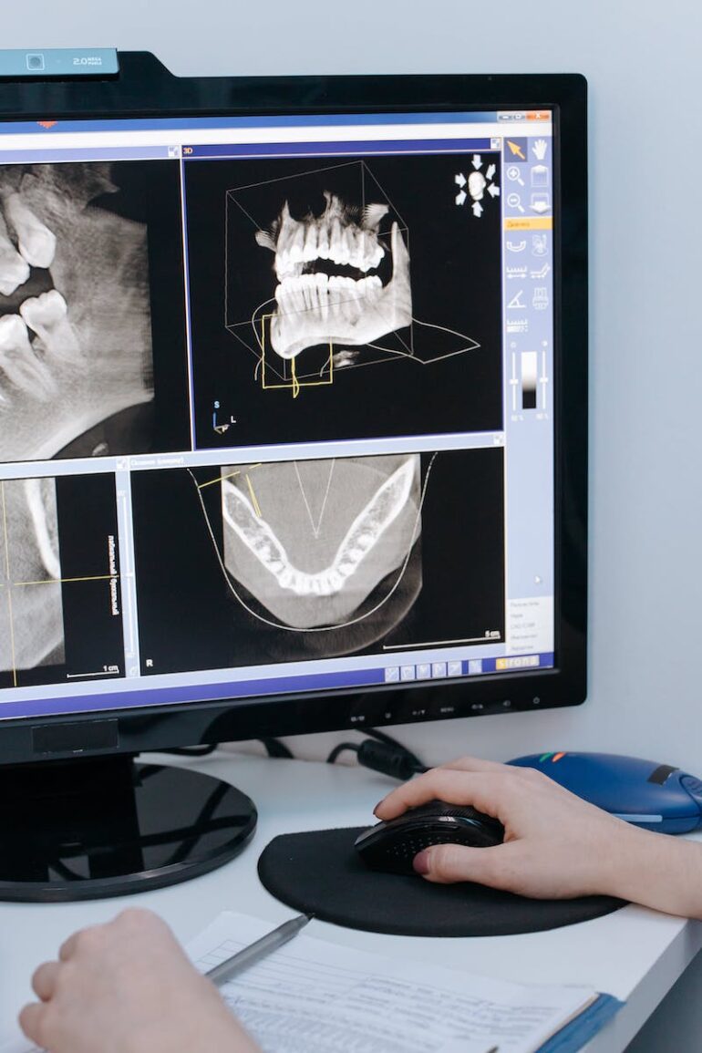Radiodent – centro de Radiodiagnóstico Dental en Bilbao